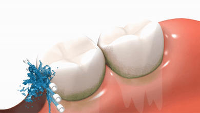Instafloss: the 10 Second Floss